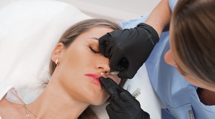 "Enhance Your Lips with Lip Thread Lift | Fab Aesthetics Mumbai"
